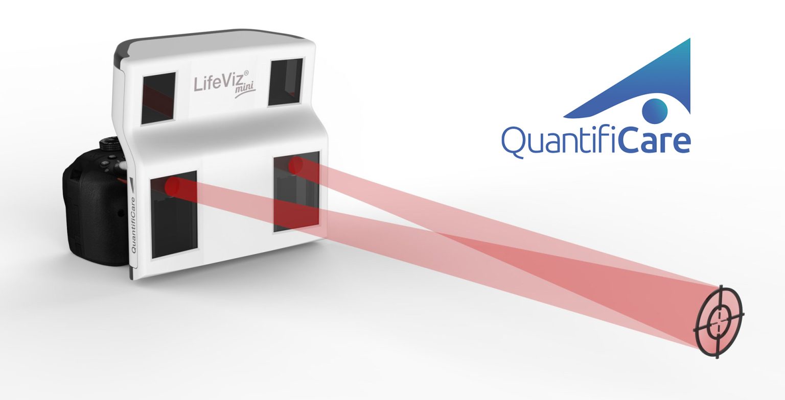 Scanex estetiske lasere - Scanex Medical Systems AS